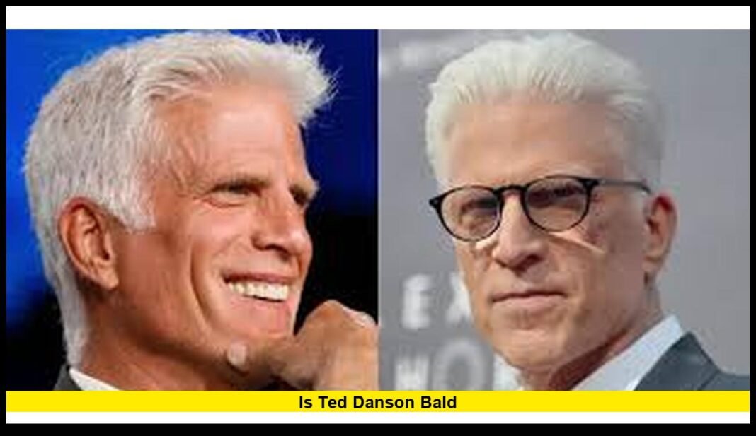 Is Ted Danson Bald? A Clear Look at His Hair, Aging, and Public ...