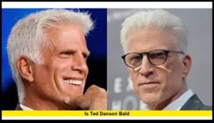Is Ted Danson Bald? A Clear Look at His Hair, Aging, and Public ...